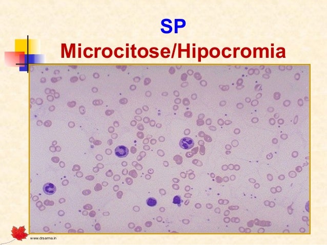 2 anemias - visão geral