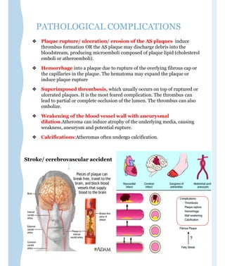 2- ATHEROSCLEROSIS and its pathophysiology | PDF