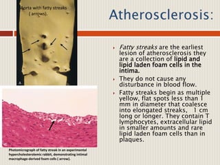 CVS pathology 2- atherosclerosis 2019, sufia husain | PPTX