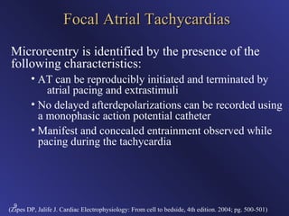 Paroxysmal Atrial Tachycardia