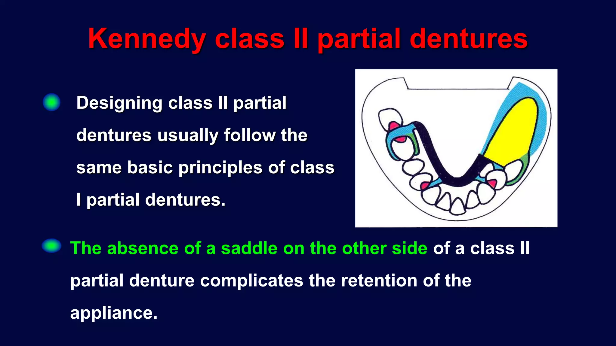 2- b. Basic principles for designing Kennedy class II, III and IV ...