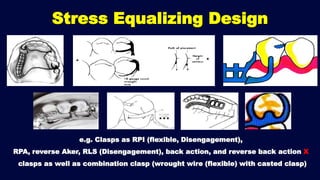 2- b. Basic principles for designing Kennedy class II, III and IV ...