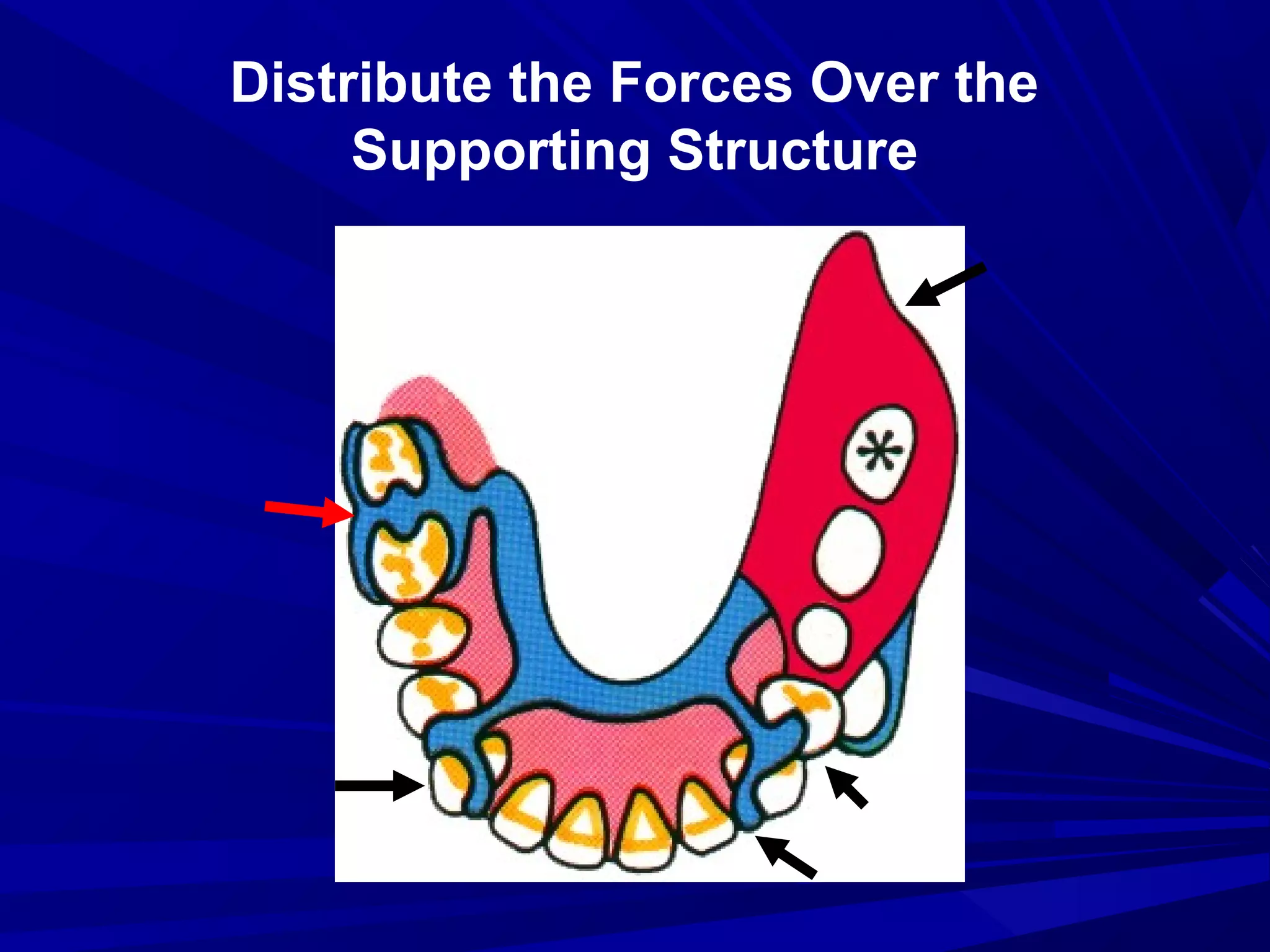 3- Basic principles for designing the removable partial denture | PPT