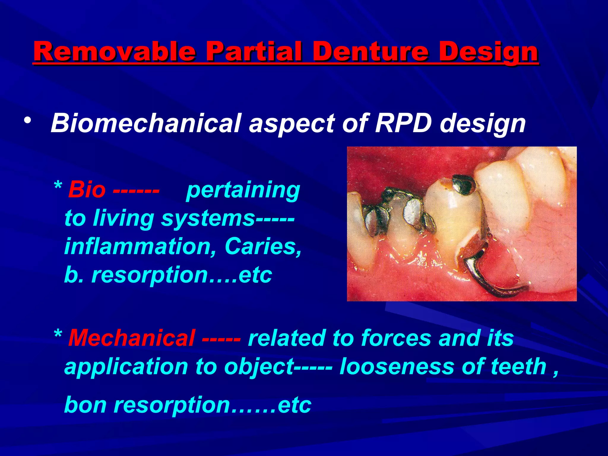 3- Basic principles for designing the removable partial denture | PPT
