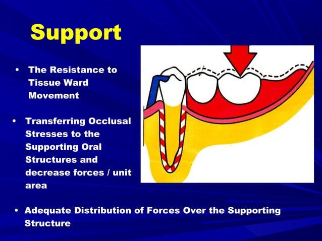 3- Basic principles for designing the removable partial denture | PPT