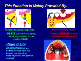 3- Basic principles for designing the removable partial denture | PPT