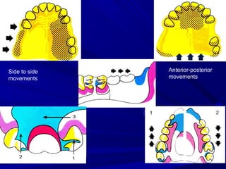 3- Basic principles for designing the removable partial denture | PPT