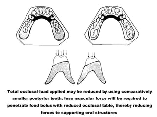 3- Basic principles for designing the removable partial denture | PPT