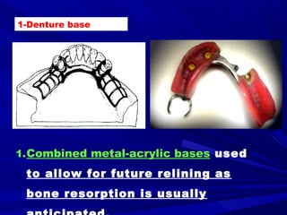3- Basic principles for designing the removable partial denture | PPT