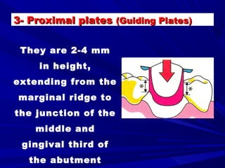 3- Basic principles for designing the removable partial denture | PPT