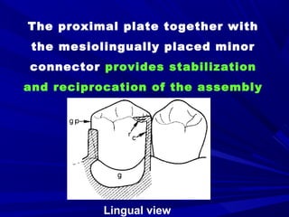 3- Basic principles for designing the removable partial denture | PPT