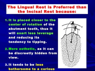3- Basic principles for designing the removable partial denture | PPT