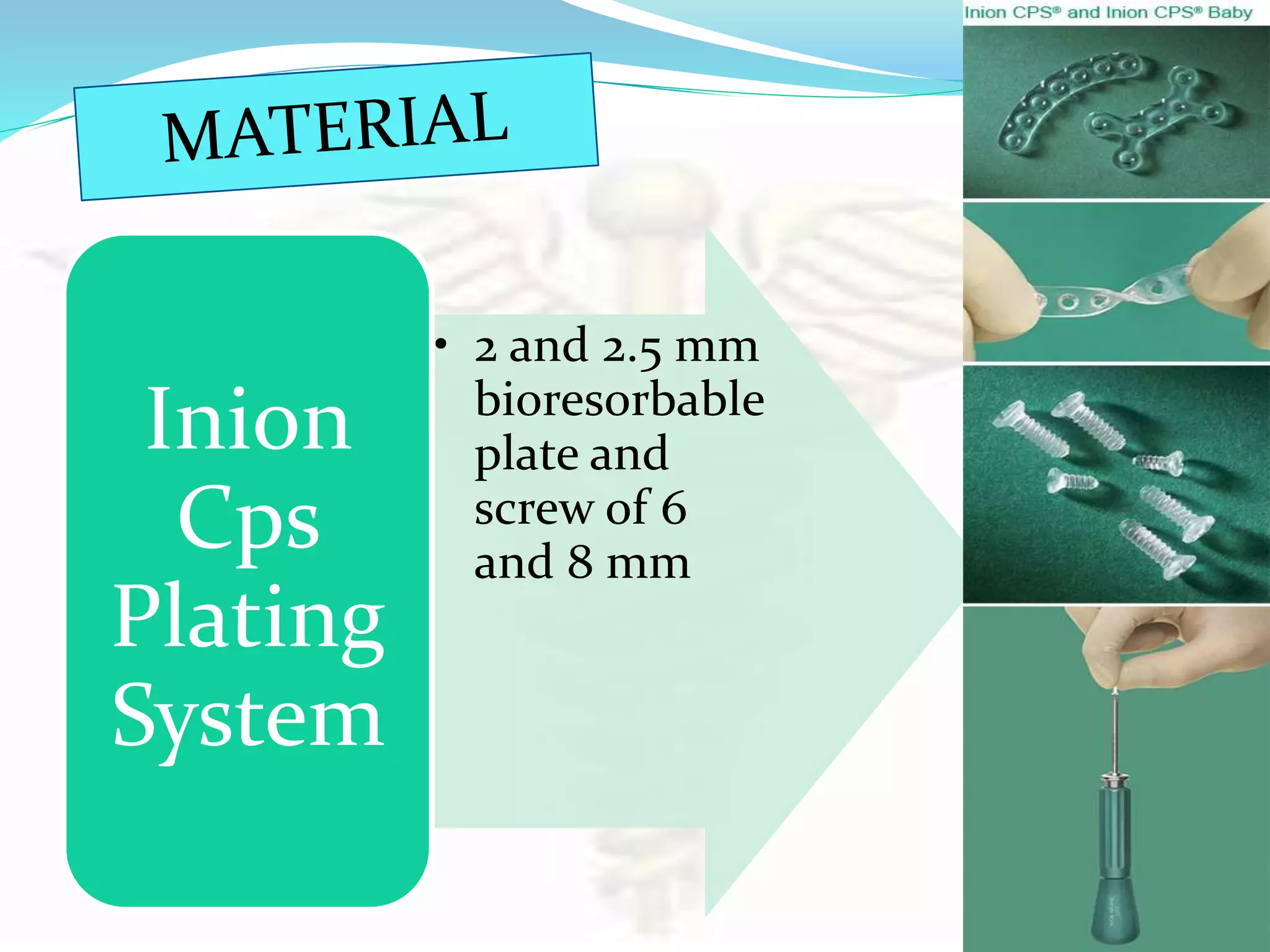 2 bio resorbable plates as effective implant in pediatric mandibular ...