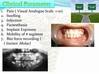 2 bio resorbable plates as effective implant in pediatric mandibular ...