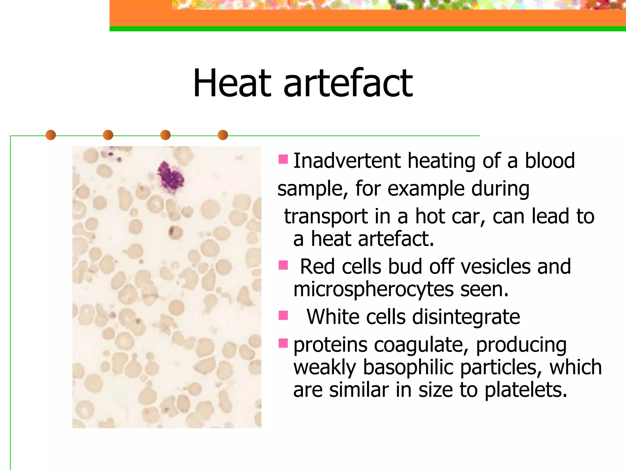2. blood cells morphology | PPT