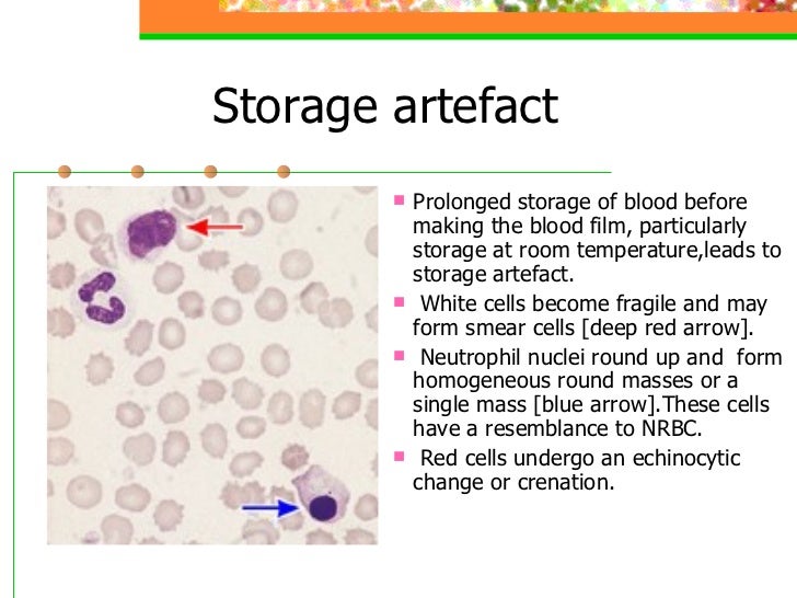 2. blood cells morphology