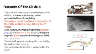 2-Bones of the upper limb................. | PDF