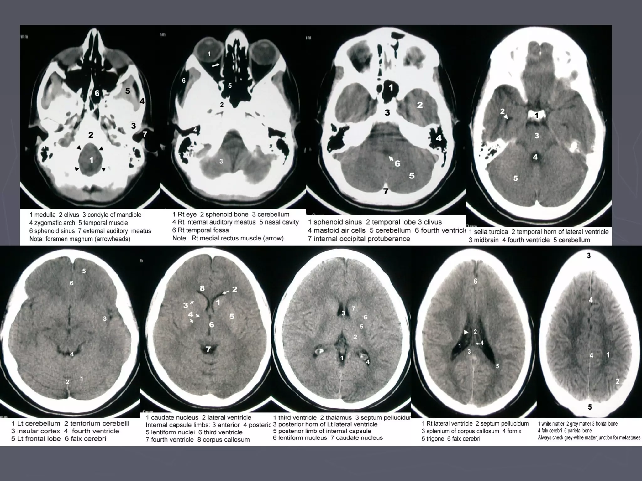 2- Brain emergency | PPT