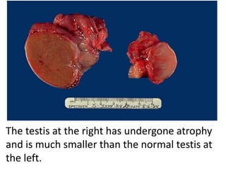 2-__cell_injury_-_adaptation.pptx | Pregnancy | Reproductive Health