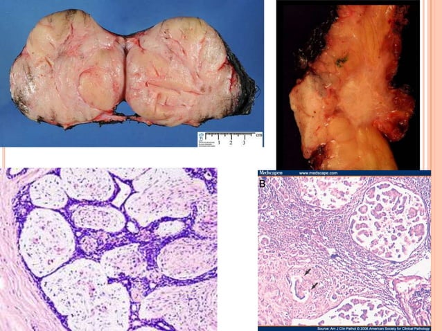2. Cellular Aberration | PPTX | Cancer | Diseases and Conditions