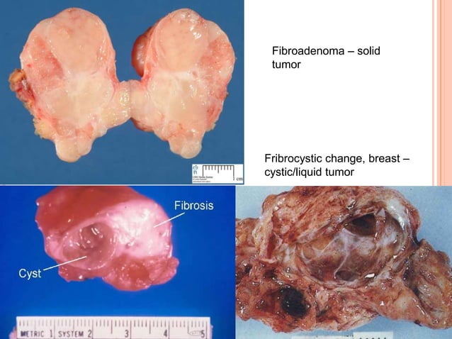 2. Cellular Aberration | PPTX | Cancer | Diseases and Conditions