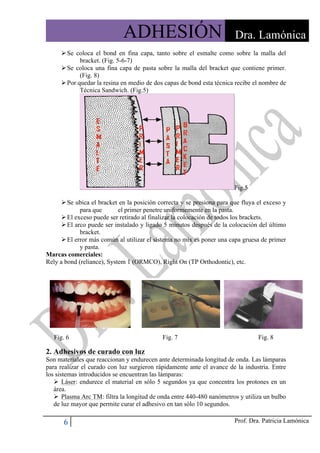 2 Cementado de Brackets | PDF