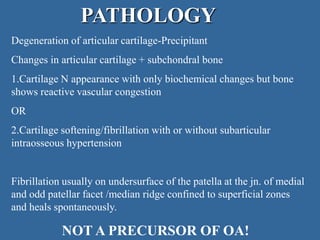chondromalacia patellae | PPT