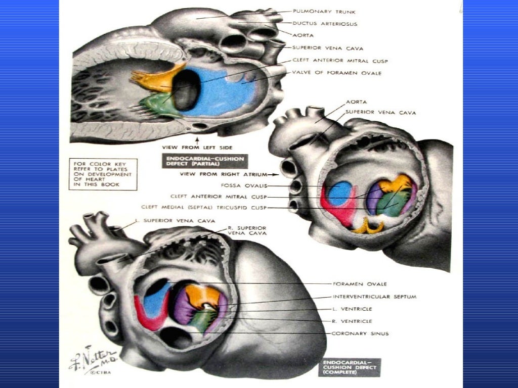 ComunicacióN Interauricular