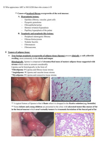 2 connective tissue neoplasms | PDF
