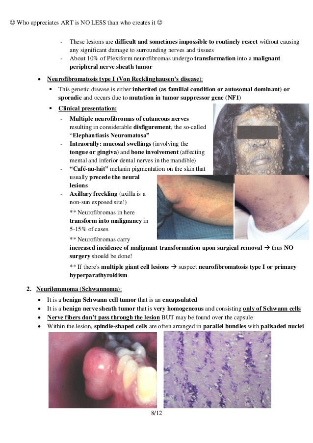 2 connective tissue neoplasms
