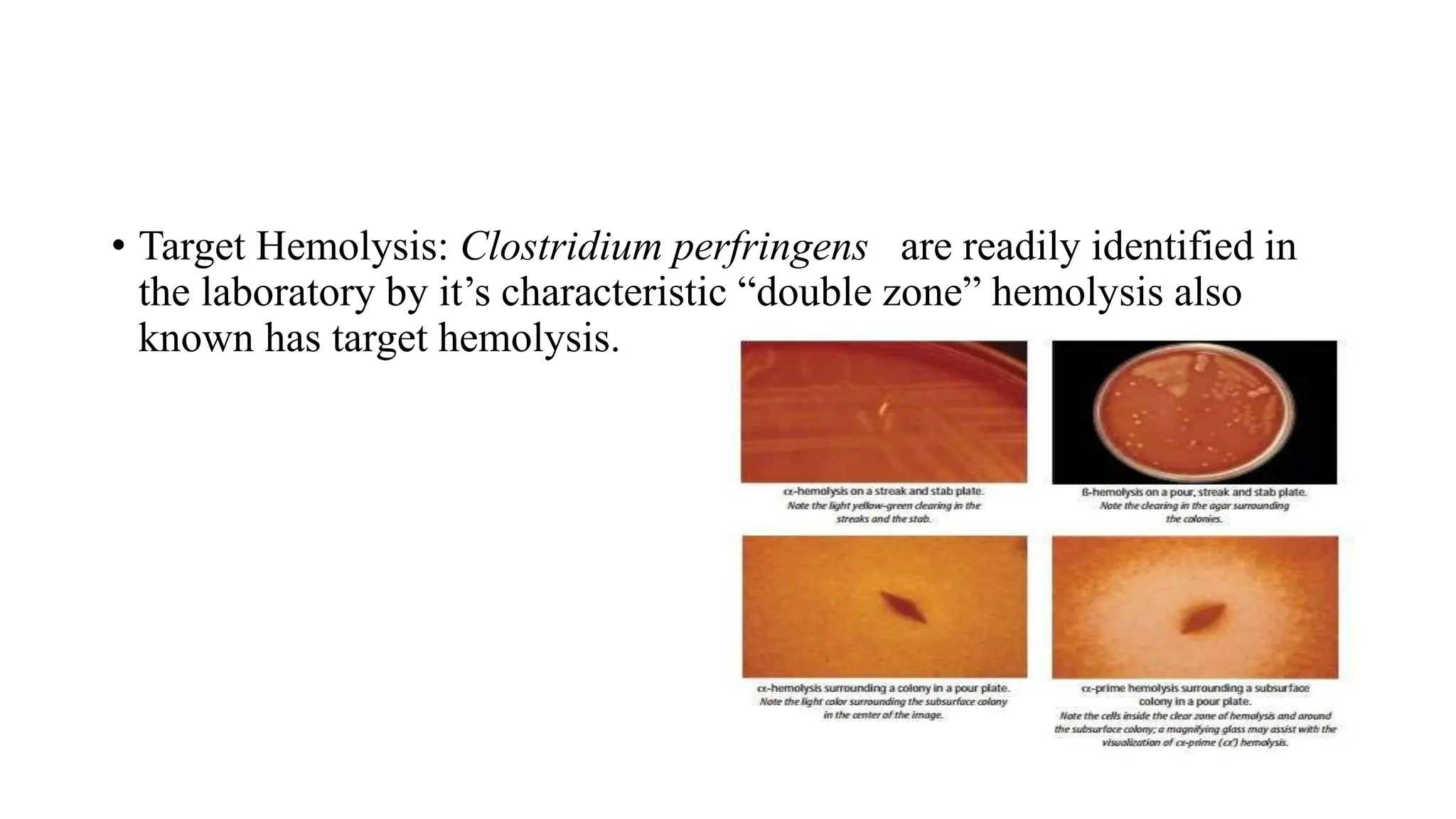 2-culturemediabloodagar microsporum.pptx