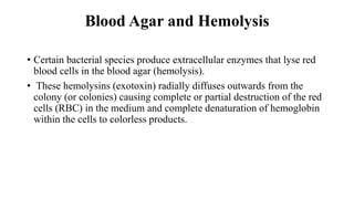 2-culturemediabloodagar microsporum.pptx