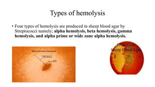 2-culturemediabloodagar microsporum.pptx