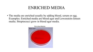 2-culturemediabloodagar microsporum.pptx