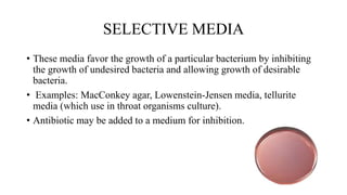 2-culturemediabloodagar microsporum.pptx