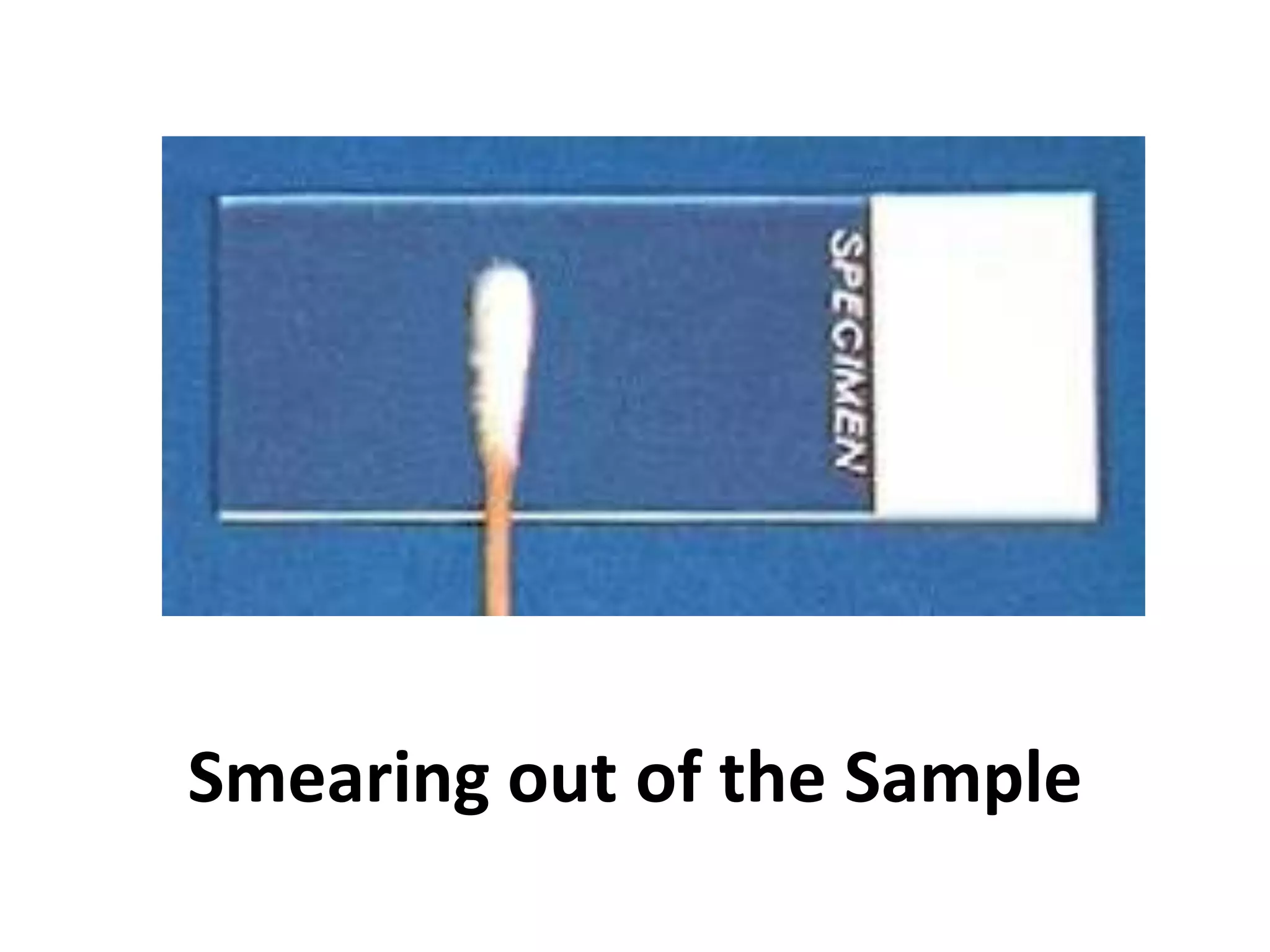 2- Diagnosis of inf. and staining.ppt | Infectious Diseases | Diseases ...