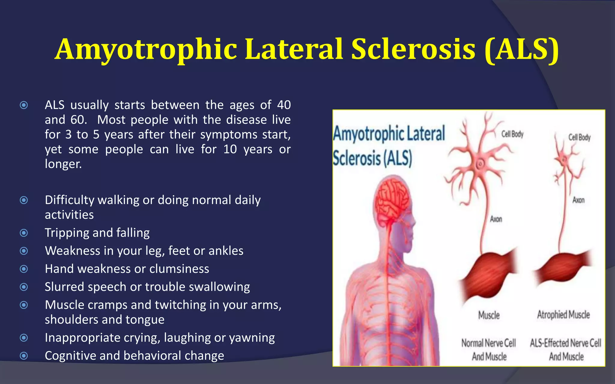Motor Neuron Diseases | PPTX