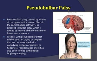 Motor Neuron Diseases | PPTX
