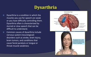 Motor Neuron Diseases | PPTX