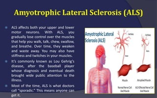 Motor Neuron Diseases | PPTX