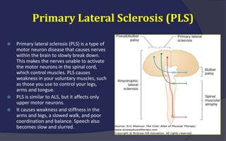 Motor Neuron Diseases | PPTX