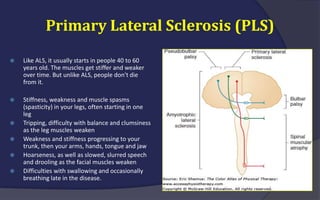 Motor Neuron Diseases | PPTX