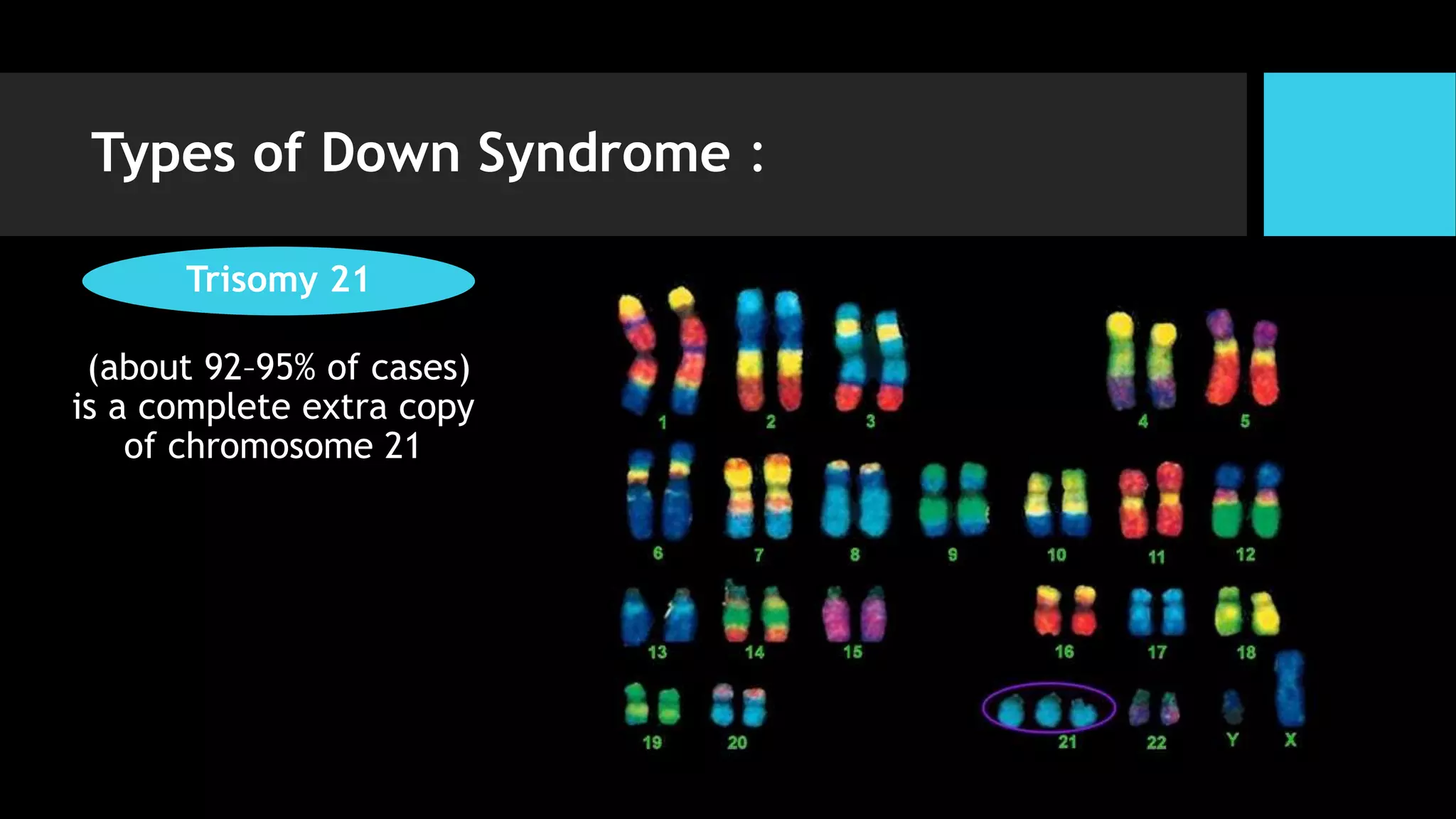 Down’s syndrome health problems and strategies for care | PPSX | Brain ...