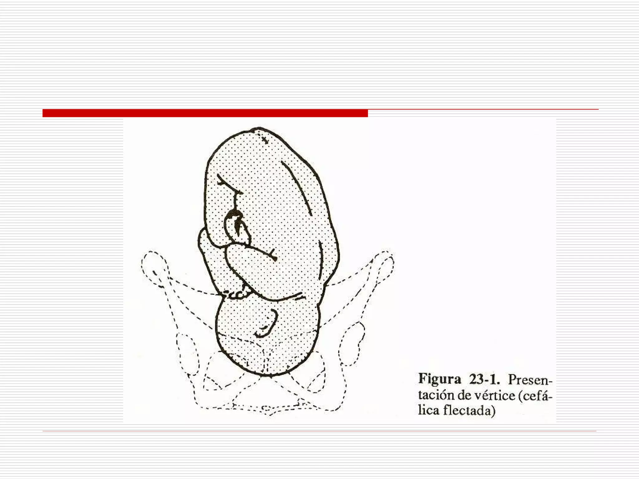 2. el parto en la presentación de vertice | PPT | Pregnancy ...