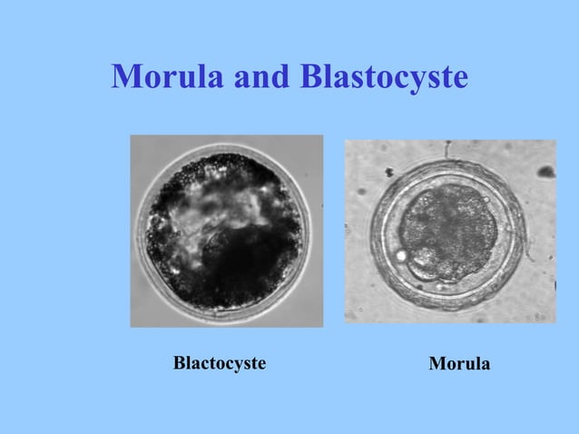 2- Embryo Transfer in farm animal23.ppt | Infertility | Reproductive Health