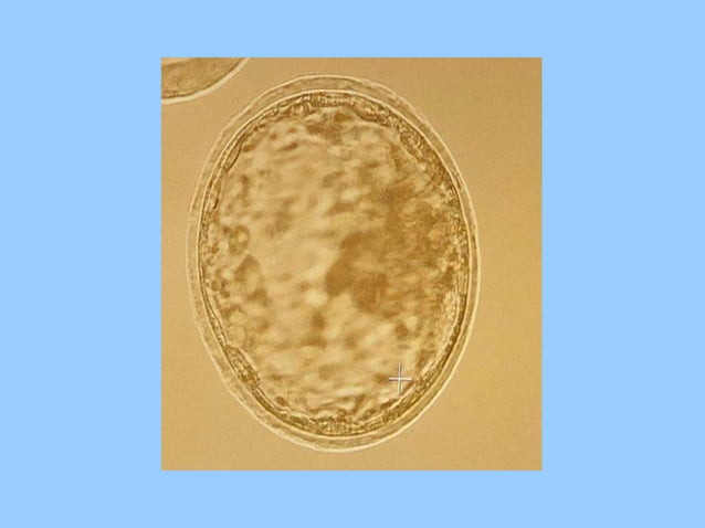 2- Embryo Transfer in farm animal23.ppt | Infertility | Reproductive Health
