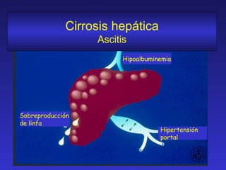 2. enfermedades hepaticas. cirrosis | PPT