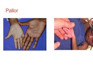 2-Essential-Symptoms-Signs-_-May-2017.pdf