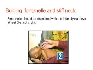 2-Essential-Symptoms-Signs-_-May-2017.pdf