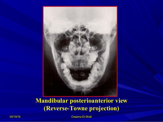 2 extra-oral radiography